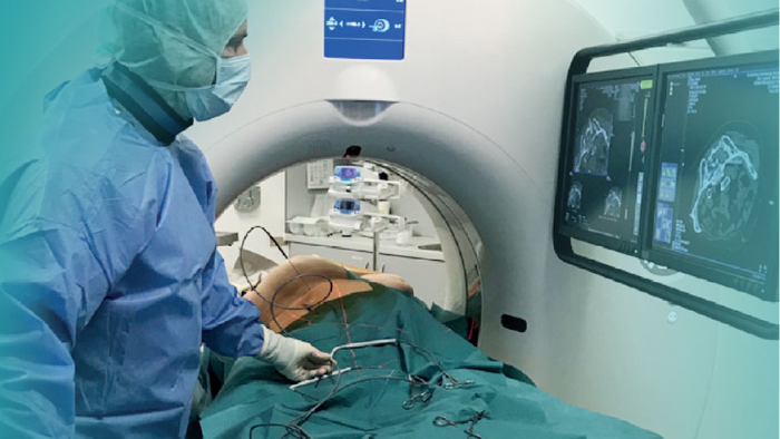 Interventional oncology & embolisation - Boston Scientific