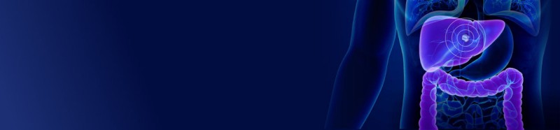 EPOCH trial - Boston Scientific