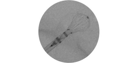 WATCHMAN FLX-PRO - Boston Scientific