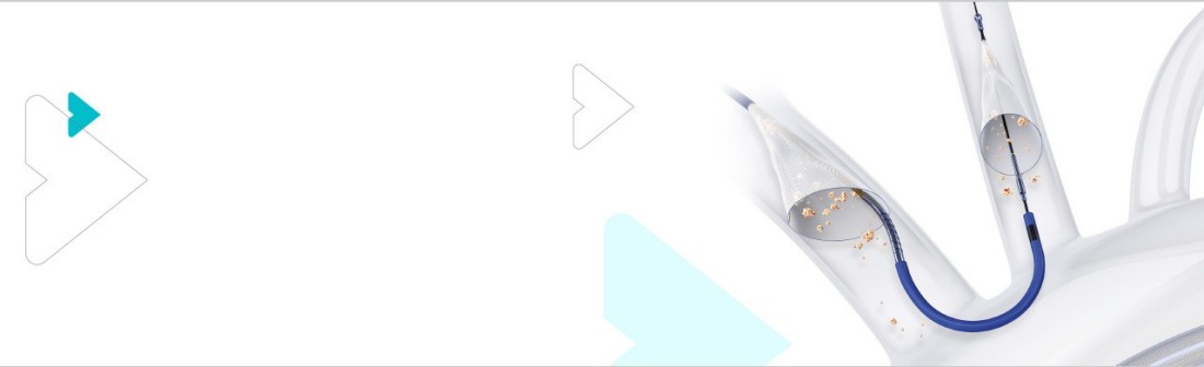 SENTINEL™ Cerebral Protection System - Boston Scientific