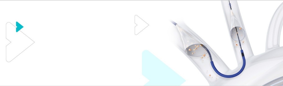 SENTINEL™ Cerebral Protection System - Boston Scientific