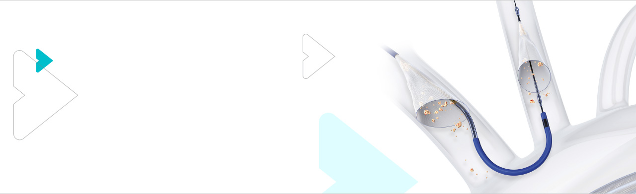 SENTINEL™ Cerebral Protection System - Boston Scientific