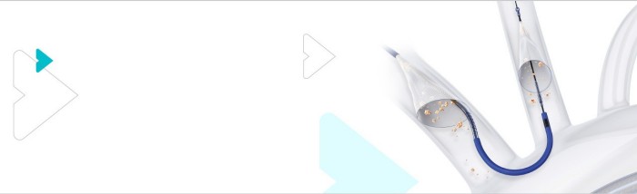 SENTINEL™ Cerebral Protection System - Boston Scientific