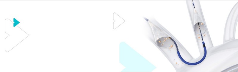 SENTINEL™ Cerebral Protection System - Boston Scientific