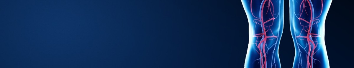 DVT disease overview - Boston Scientific