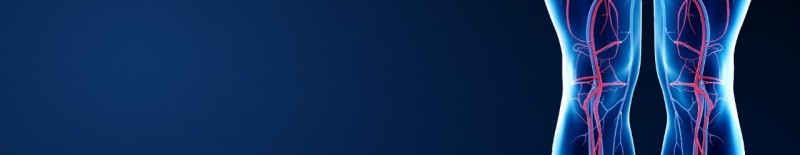 DVT disease overview - Boston Scientific