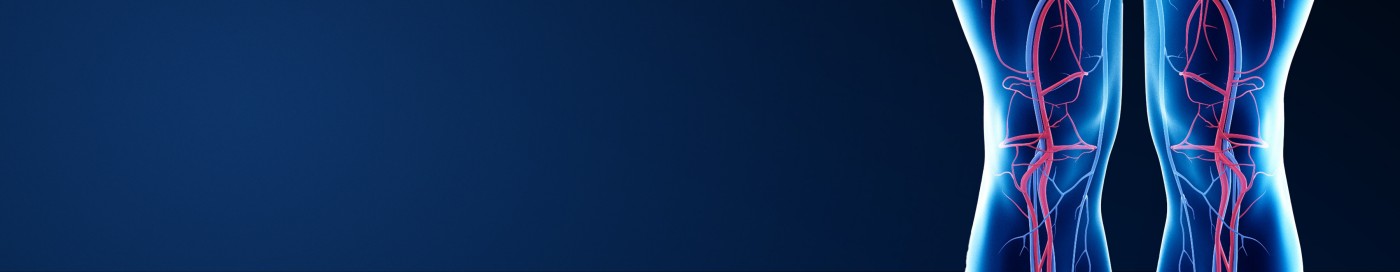 DVT treatment options - Boston Scientific