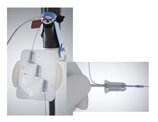 X-Tack™ - Boston Scientific