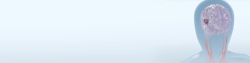 TAVR Stroke Risk : Aortic Valve Stenosis - Boston Scientific