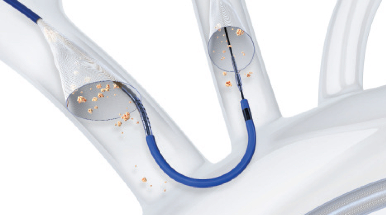 Structural Heart Valve Therapies Solutions Portfolio - Boston Scientific