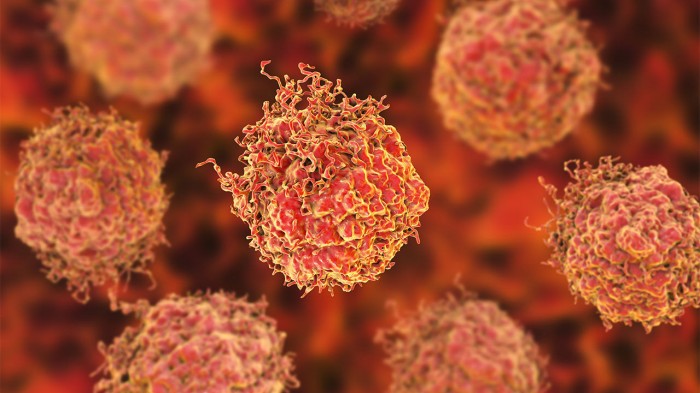 Advancing Science for Life - US - Boston Scientific