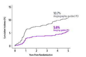 IVUS Data - Boston Scientific