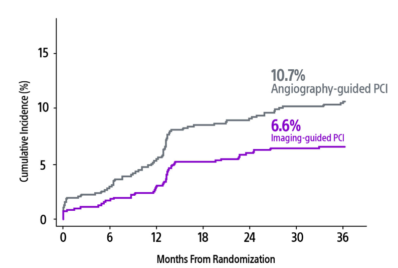 IVUS Data - Boston Scientific
