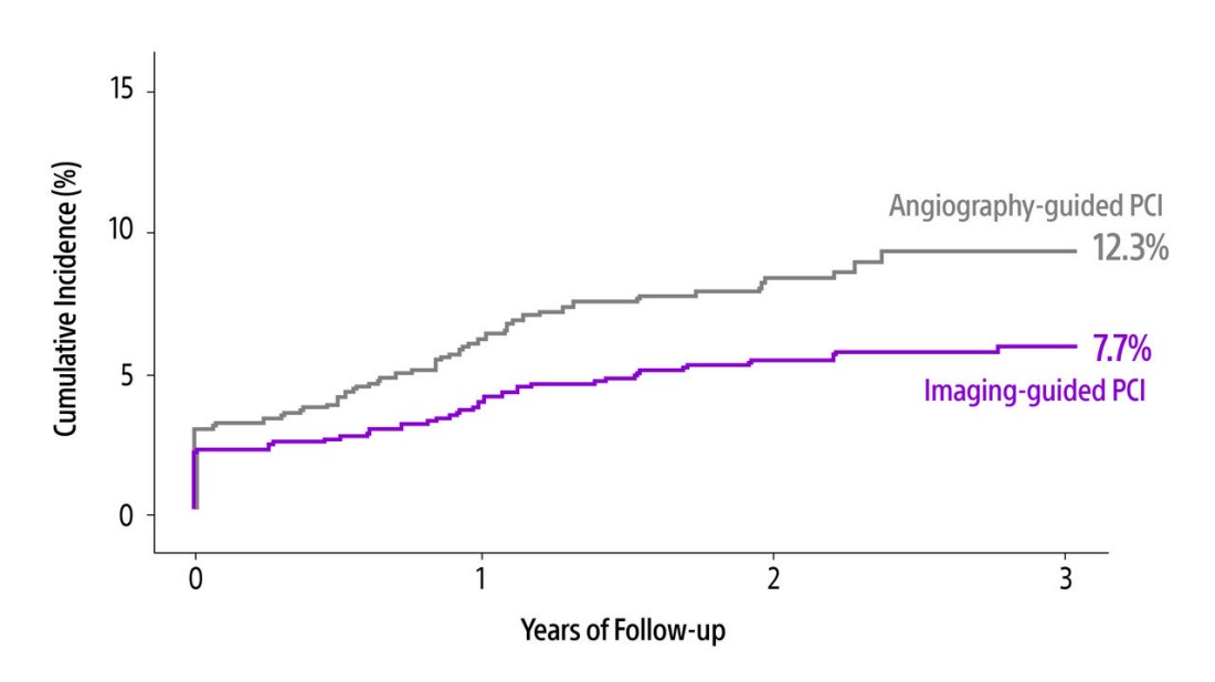 IVUS Data - Boston Scientific