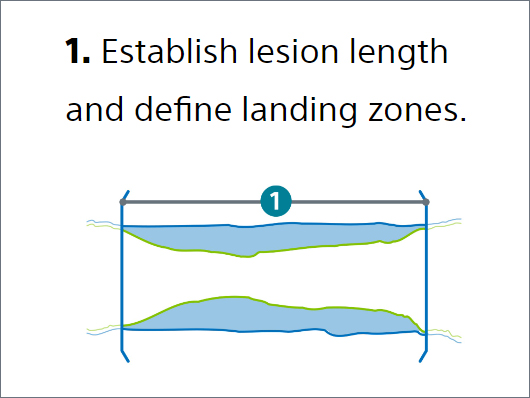 Coronary Imaging Solutions - Boston Scientific