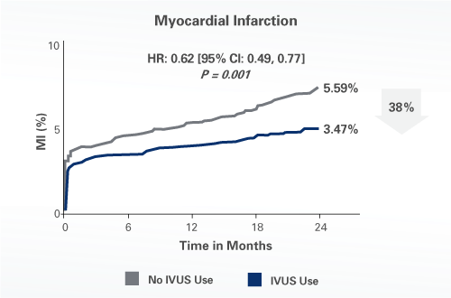Intravascular Ultrasound - Boston Scientific