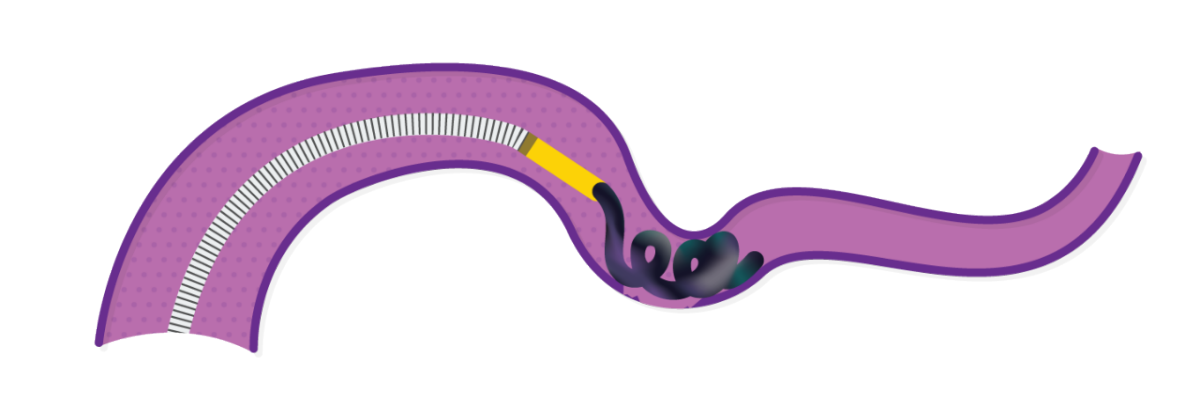 About Obsidio™ Conformable Embolic - Boston Scientific