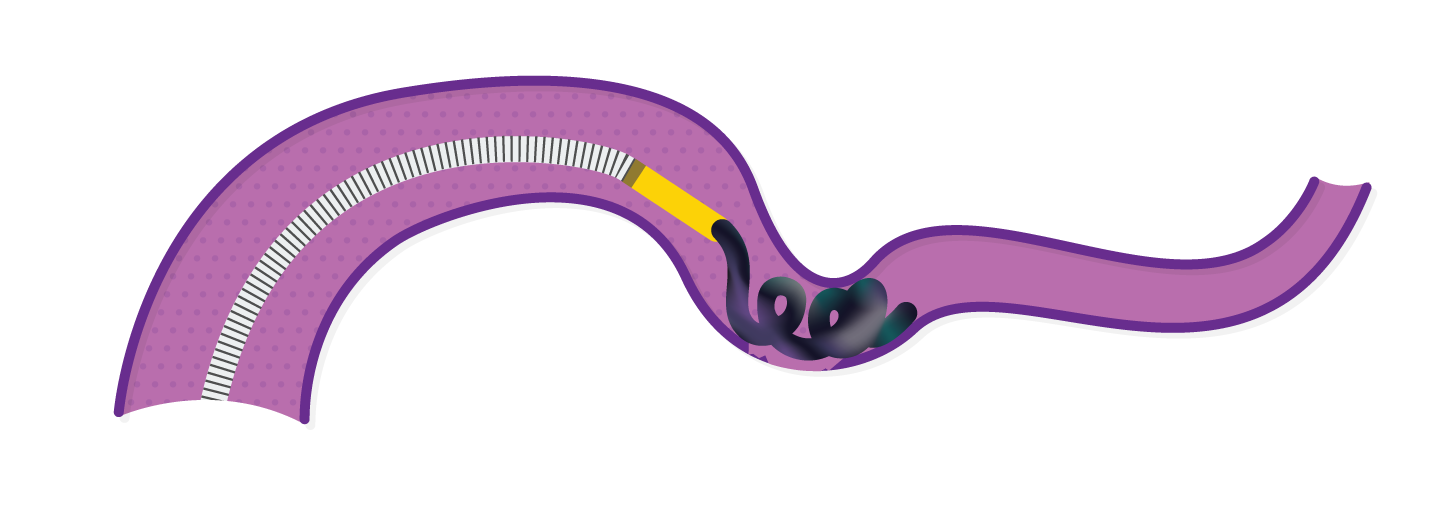 About Obsidio™ Conformable Embolic - Boston Scientific