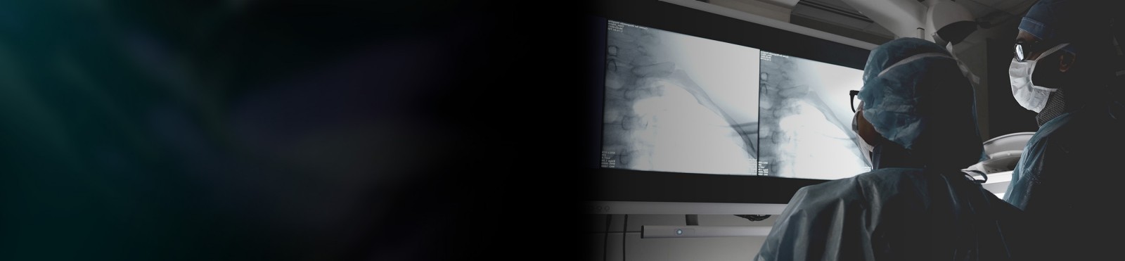 FAQs - Obsidio™ Conformable Embolic - Boston Scientific