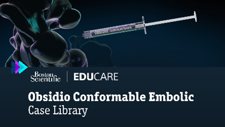 Resources - Obsidio™ Conformable Embolic - Boston Scientific