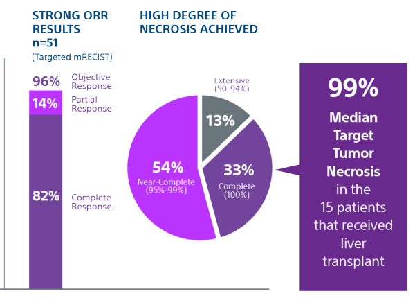 Ochsner Tumor Dose Analysis with TheraSphere™ - Boston Scientific
