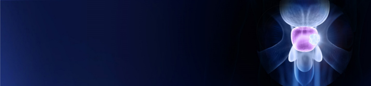 VOYAGER Study on Prostate Cancer with TheraSphere™ - Boston Scientific