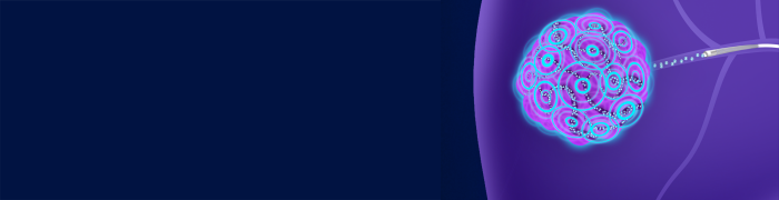 Dosage and Administration with TheraSphere™ - Boston Scientific