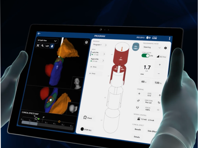 Deep Brain Stimulation System - Boston Scientific