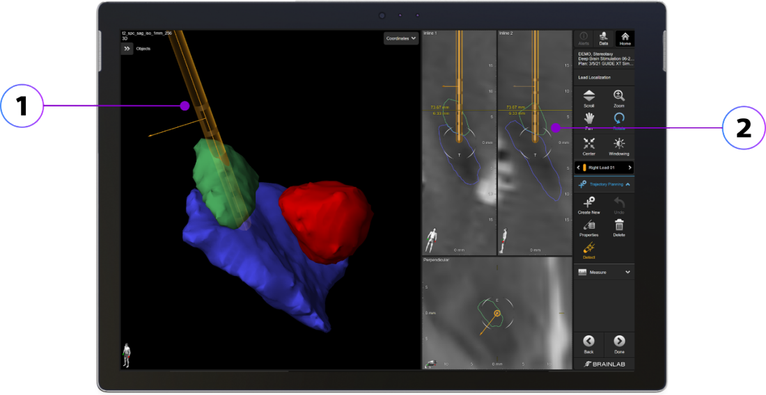 Image Guided Programming - Boston Scientific