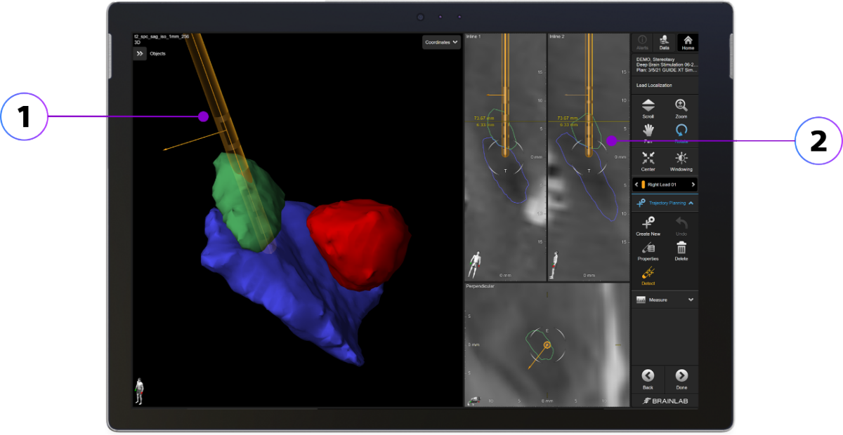 Image Guided Programming - Boston Scientific