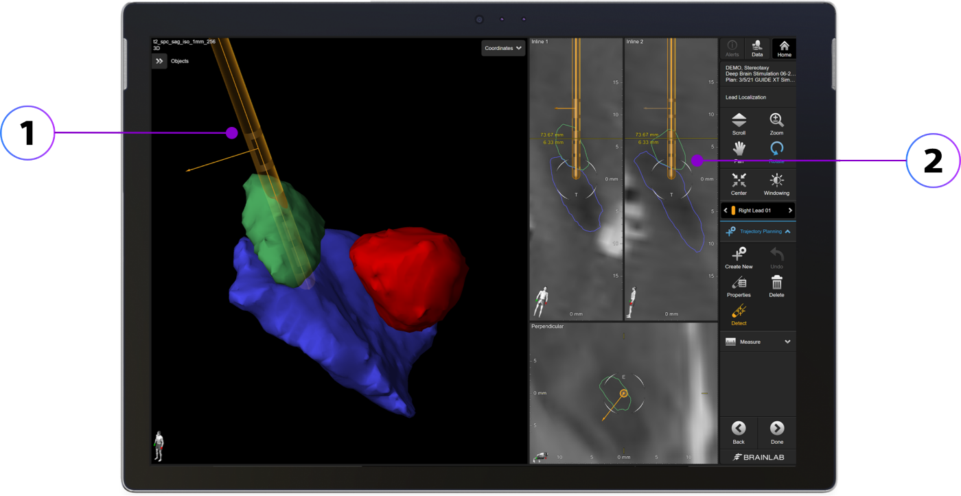 Image Guided Programming - Boston Scientific