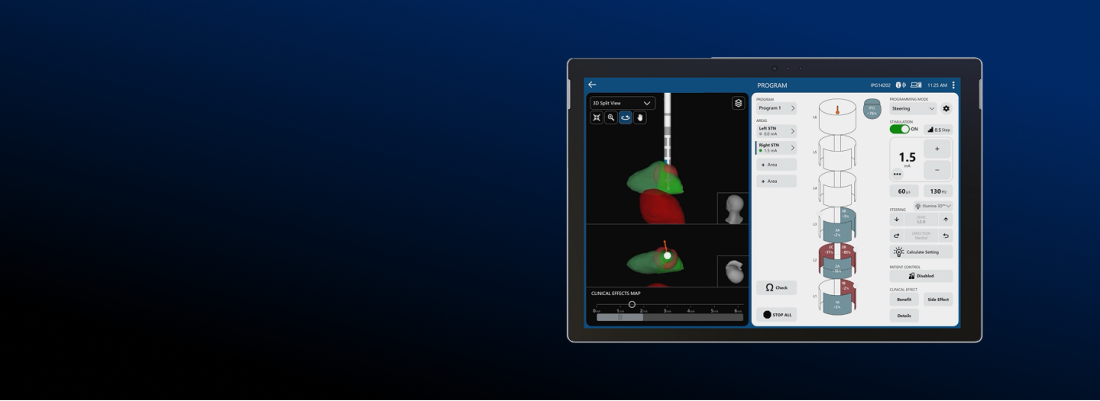 Image Guided Programming - Boston Scientific