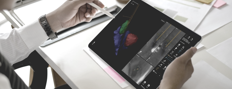 Brainlab Elements - Boston Scientific