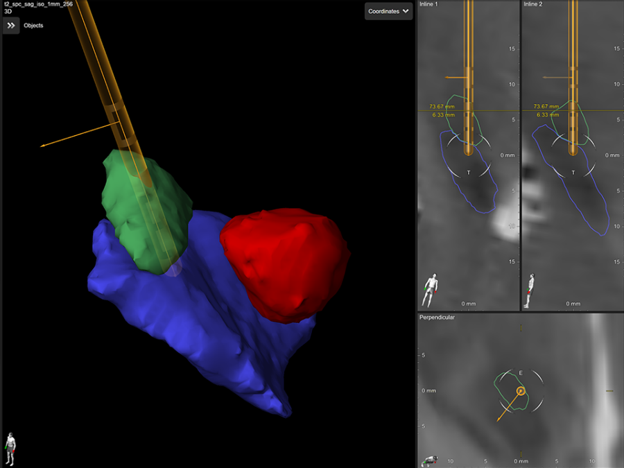 Brainlab Elements - Boston Scientific