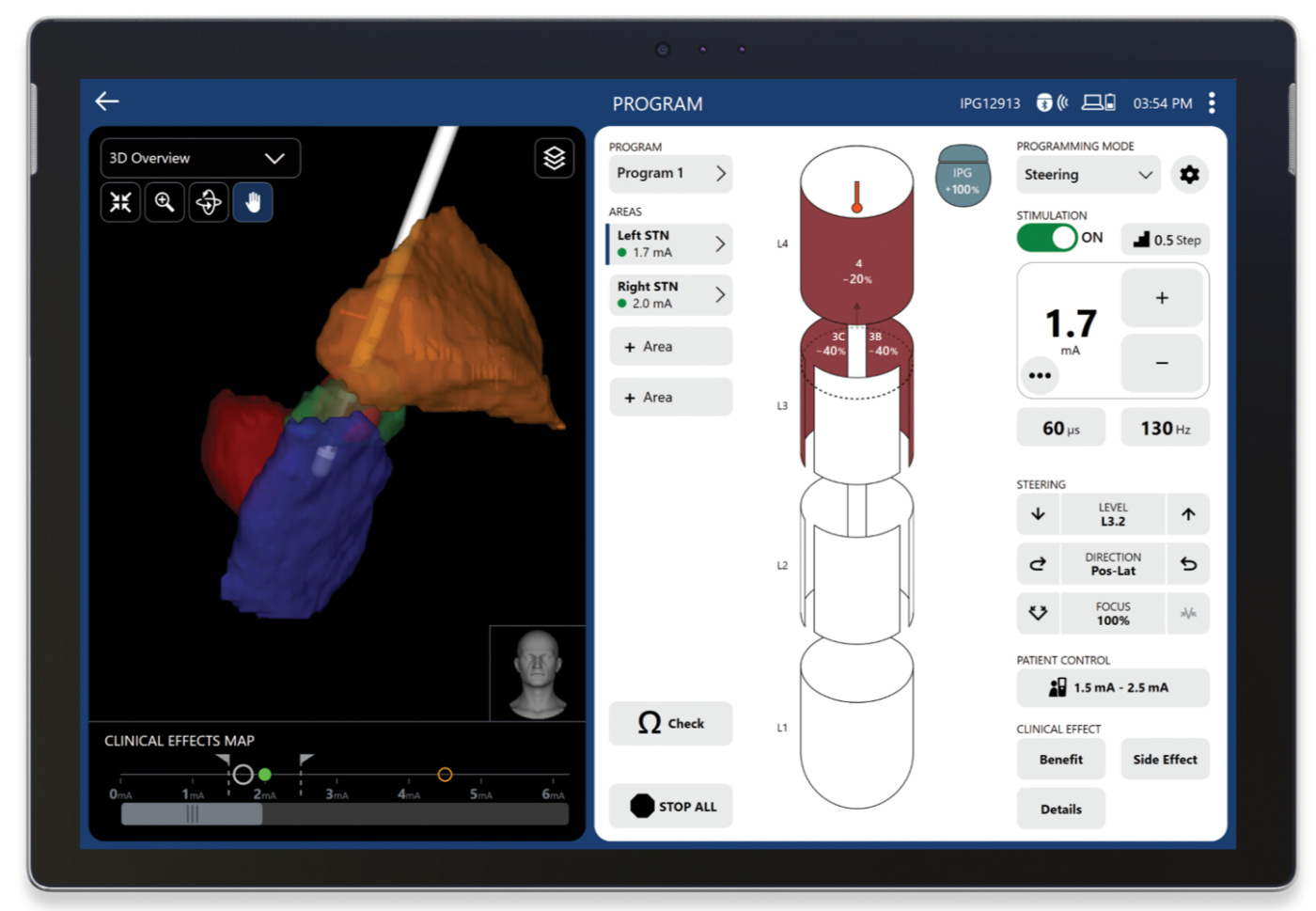 Vercise Neural Navigator 5 - Boston Scientific