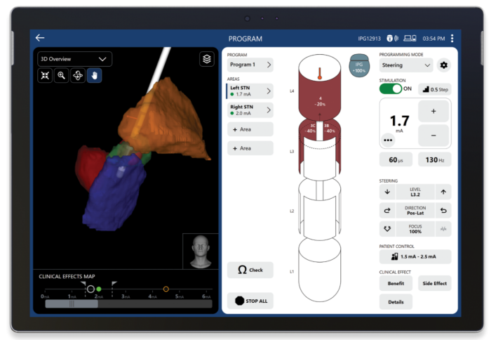 Vercise Neural Navigator 5 - Boston Scientific