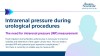 Controlling Intrarenal Pressure During Ureteroscopy May Help Reduce ...