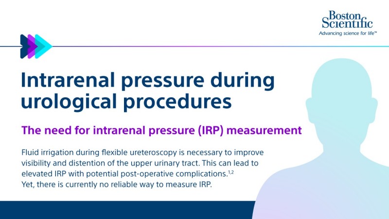 Controlling Intrarenal Pressure During Ureteroscopy May Help Reduce ...