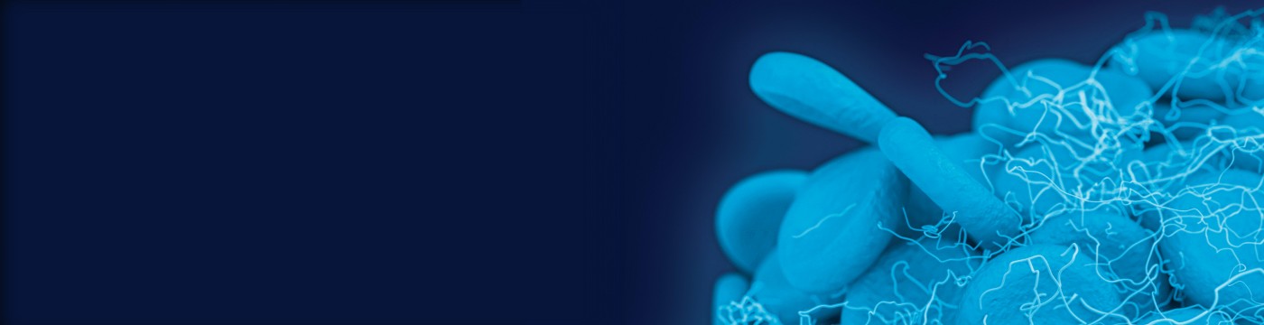 EKOS™ Endovascular System - PE Treatment - Boston Scientific