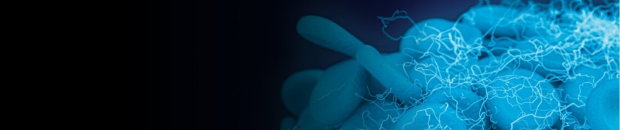 EKOS-PE Study - EKOS Endovascular System - Boston Scientific