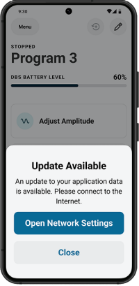 Vercise DBS Controller - Boston Scientific