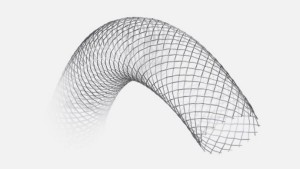 Deep Vein Thrombosis - Boston Scientific