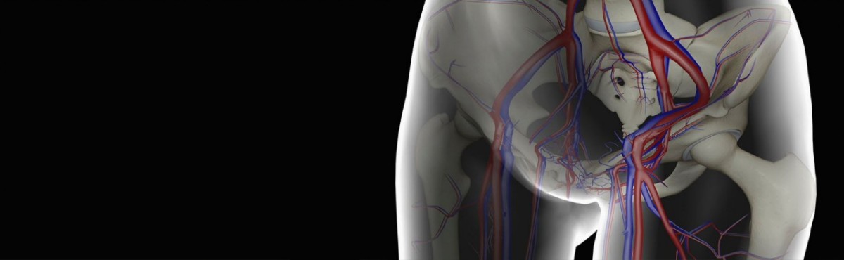 PAD Procedure - Boston Scientific