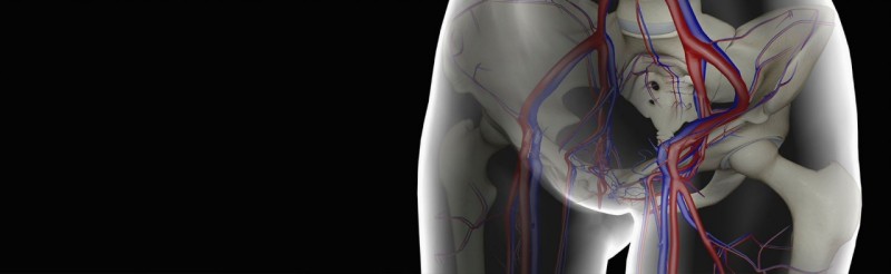 PAD Procedure - Boston Scientific